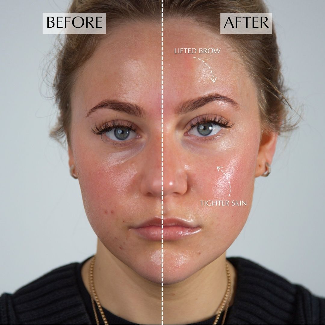 ZIIP | Expert Facials On Demand