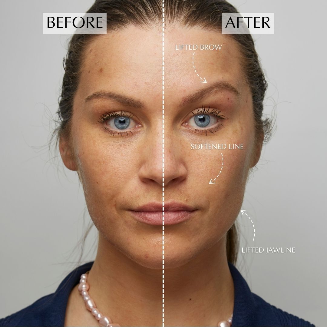 ZIIP | Expert Facials On Demand